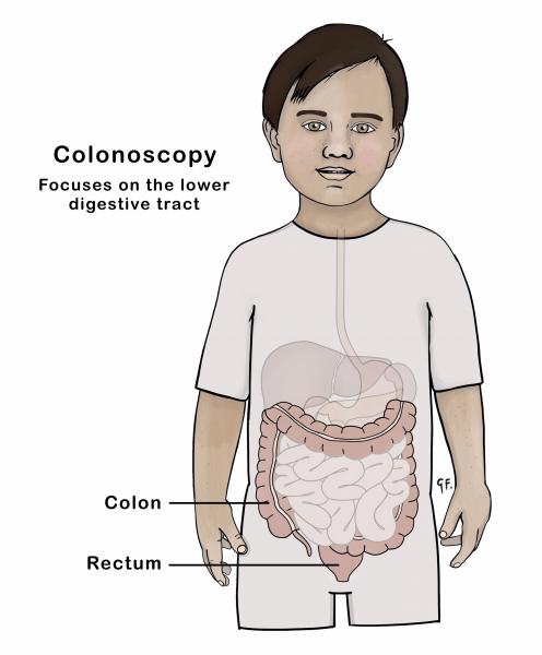 Colonoscopy In Children | KidsHealth NZ