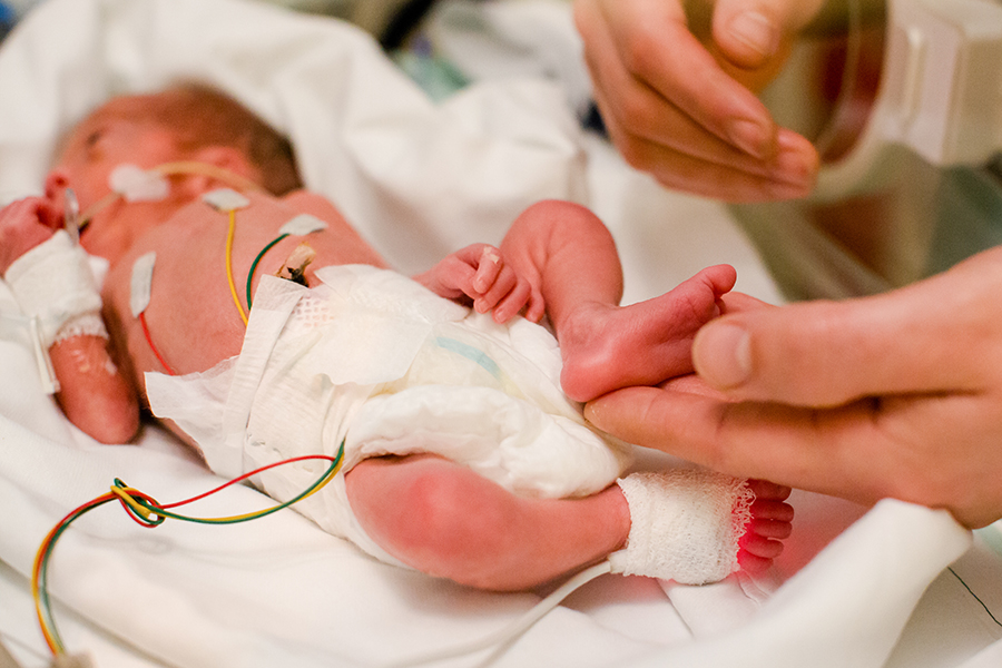 Premature babies | KidsHealth NZ